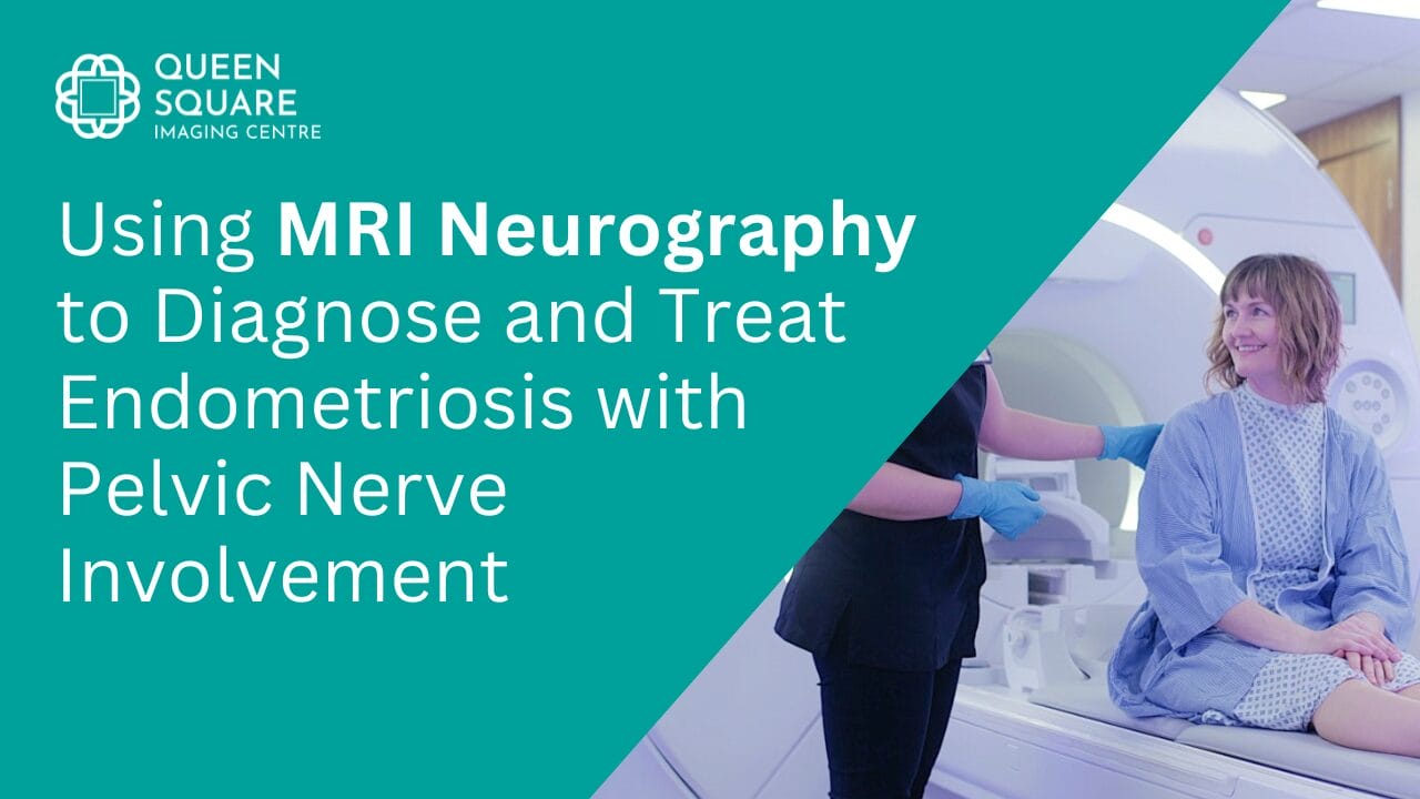 Using MRI Neurography to Diagnose and Treat Endometriosis with Pelvic ...